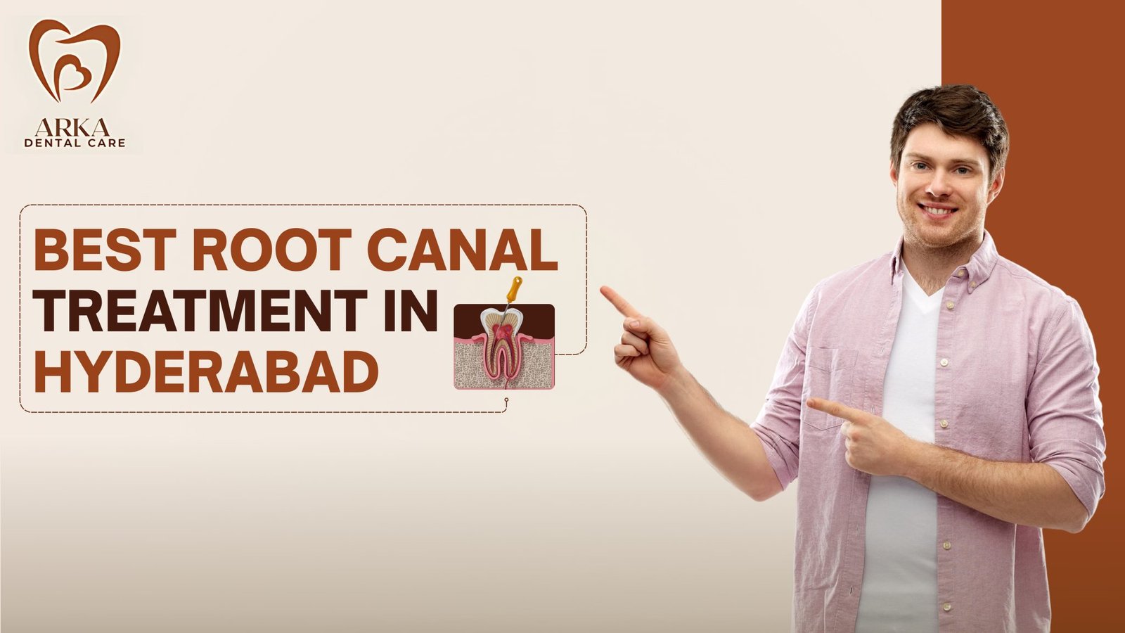 Deep Cavity Filling vs Root Canal: Best Root Canal Treatment in Hyderabad